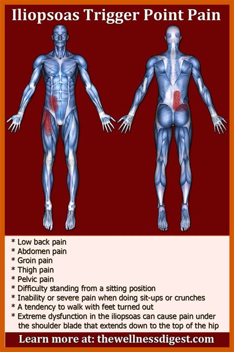 Psoas Muscle Trigger Point