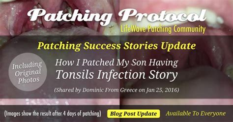 Lifewave Patches Blog By Patching Protocol