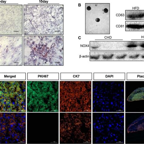 Adipocyte Derived Exosome Can Be Delivered To Placenta In Vivo A