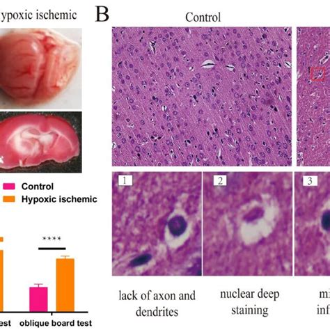 Assessment Of Cp Rat A Rat Brain Tissue Stained With Ttc Staining