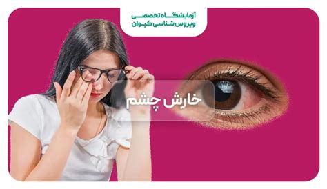علت خارش چشم چیست؟ بهترین روش‌های درمان خارش چشم