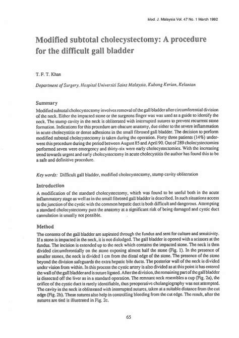 Pdf Modified Subtotal Cholecystectomy A Procedure For The E Mjm