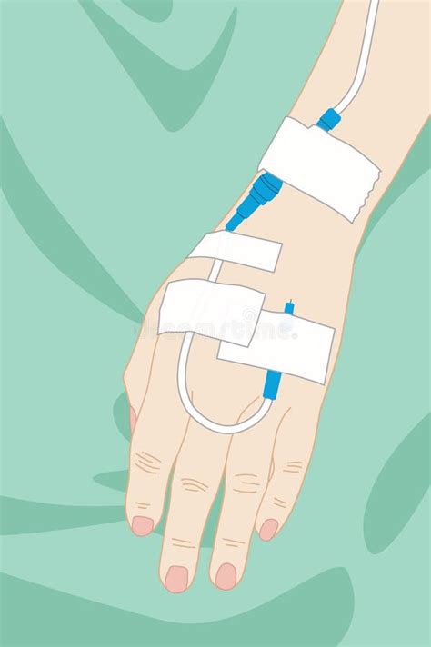 Saline Solution On A Patient Woman`s Hand Illustration Stock