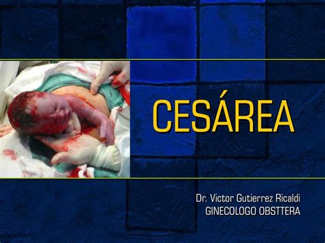 Cesarea JPaul HAsto UDocz