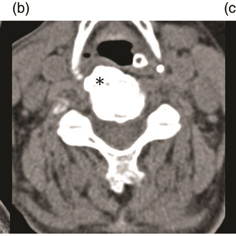 A Sagittal B Axial And C Three Dimensional Sagittal