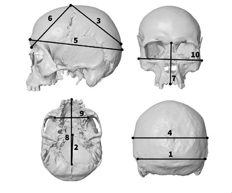 Linear Measurements Computed From 3d Cartesian Coordinates 1 Download Scientific Diagram