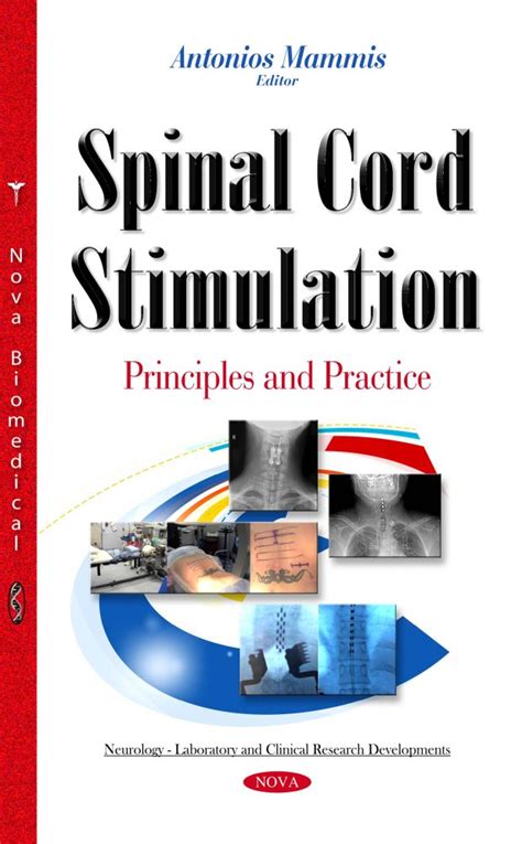 Spinal Cord Stimulation Principles And Practice Nova Science Publishers