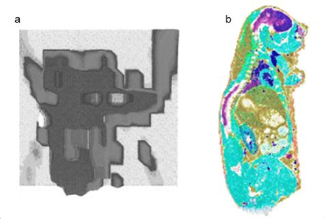 A Comparison Of Imaging Capabilities In Terms Of Spatial Resolution Download Scientific