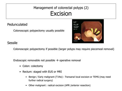 Ppt Colorectal Polyps And Polyposis Syndromes Powerpoint Presentation