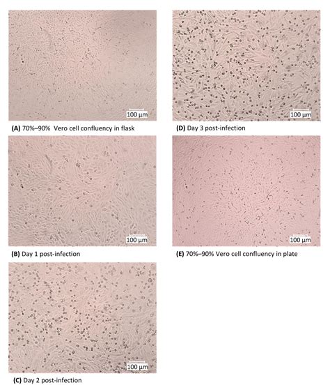 Video Virus Propagation And Cell Based Colorimetric Quantification