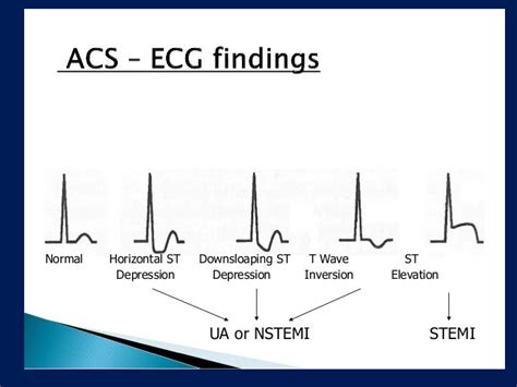 Ekg Myocardial Ischemia And Infarction Ppt