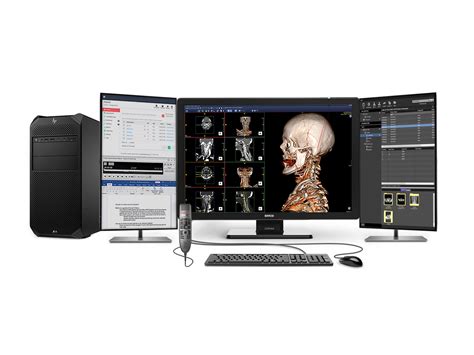 Complete Pacs General Radiology Station Barco Display Hp Workstation