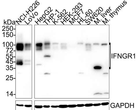 Ifngr1 Recombinant Rabbit Monoclonal Antibody [je40 50] Ha721952 Huabio
