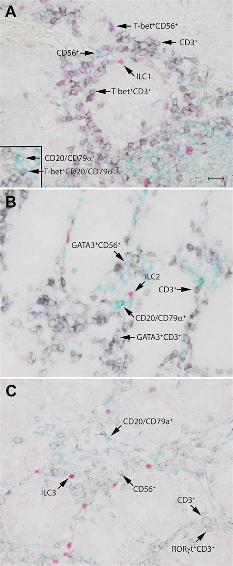 Identification Of Ilc1s A Ilc2s B And Ilc3s C In Normal Human