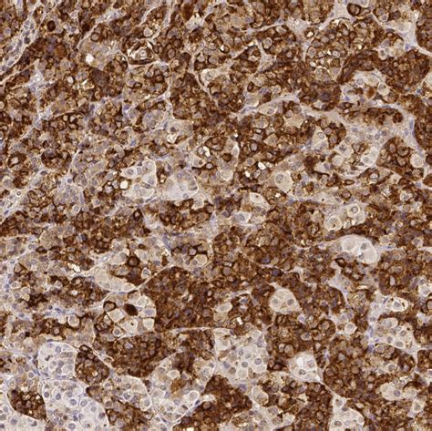 Rabbit Polyclonal Anti Prl Antibody Buy For Research Highly Specific Rigorously Validated