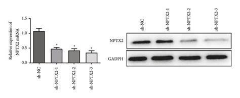Loss Function Of Nptx2 Inhibits Proliferation Migration And Immune