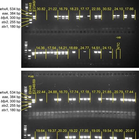 Gels Showing The Results Of A Multiplex Polymerase Chain Reaction Pcr Download Scientific
