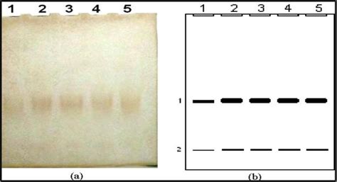 Electrophoretic Patterns A And Their Diagrame B Of Peroxidase