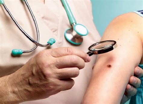 علاج جديد لأخطر أشكال سرطان الجلد