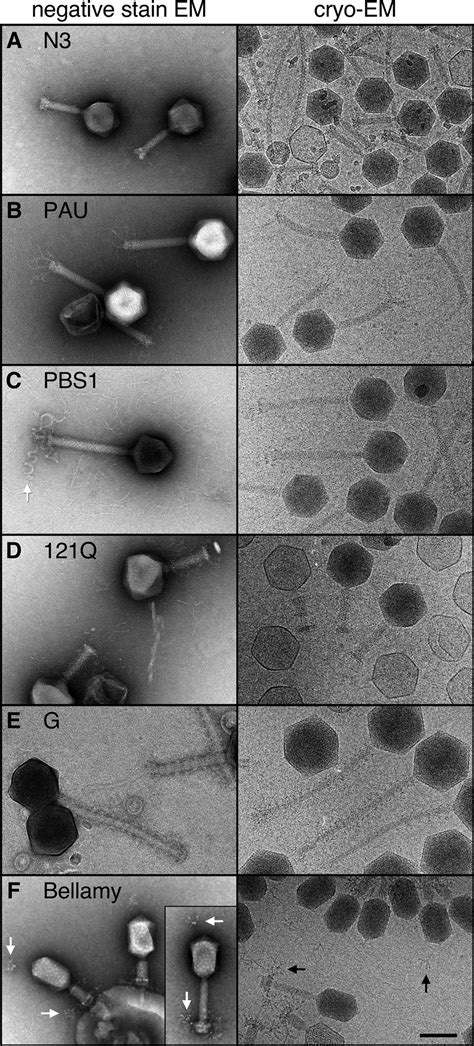 Electron Microscope Bacteriophage