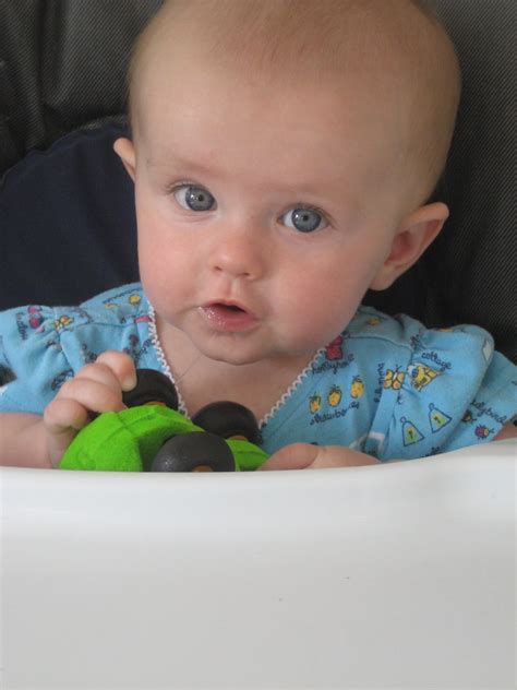 Megalencephaly Vs Macrocephaly