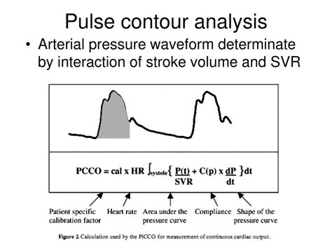 Ppt Advance In Hemodynamic Monitoring Powerpoint Presentation Free Download Id593454