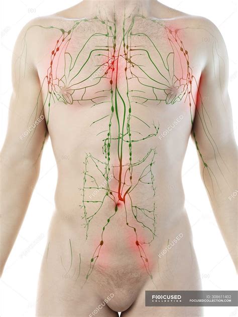 Enlarged Lymph Nodes In Male Body Conceptual Computer Illustration