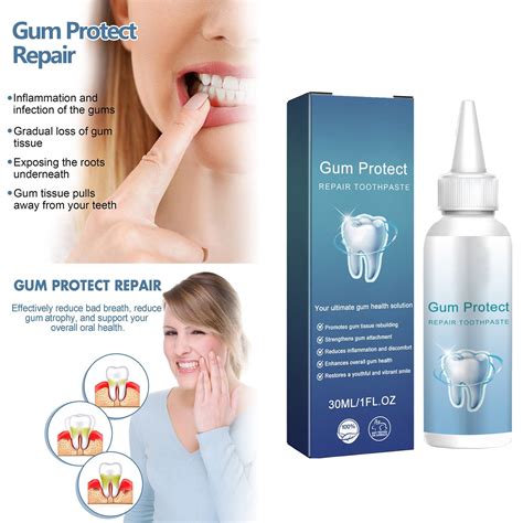Gingival Cleaning Of Stains And Yellowing And Of Teeth Oral Health Care