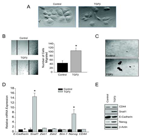 TGFβ induced EMT cells with CSC characteristics A Phase contrast