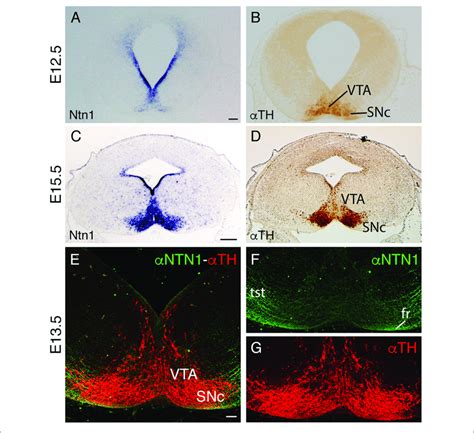 Ntn1 And Ntn1 In The Snc And Vta Ab Adjacent Coronal Paraffin