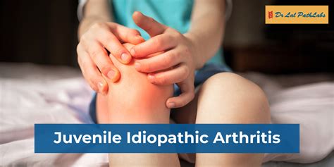 Juvenile Idiopathic Arthritis Symptoms Diagnosis And Management Dr