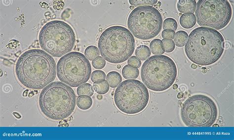 Microscopic Bright Field Light Microscope Image Of Trichophyton