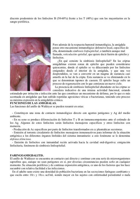 Amigdalitis Aguda