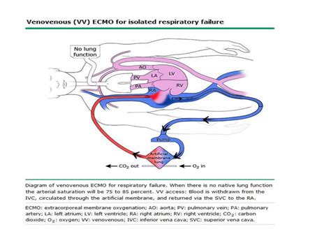 Ecmo Pptx