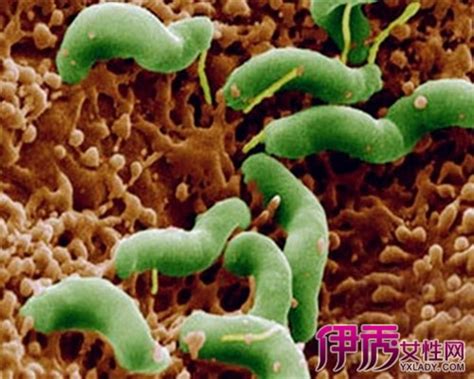 幽螺旋门杆菌如何感染图幽螺旋门杆菌如何感染的 专家为你奉上医学宝典 伊秀健康 yxlady