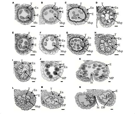 Semi Thin Section Comparison Of Anther Development In The Wt And The