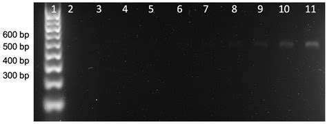 Gel Electrophoresis Of The Double Tagging Pcr Amplification Of The E
