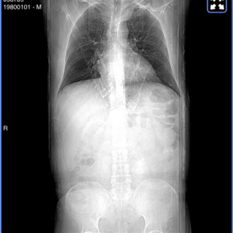 Postdicom Free Dicom Viewer Alternatives And Similar Websites And Apps