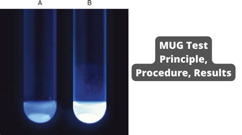 Bacitracin Susceptibility Test Principle Procedure Result Biology