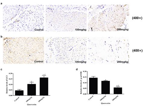 Immunohistochemical Staining Of Lc3 And P Mtor In Epidural Fibrosis Download Scientific Diagram