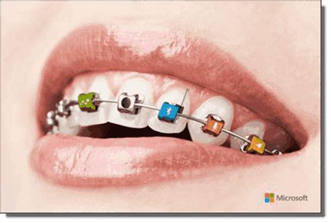 Microsoft Announces Beta Version Of Microsoft Braces 4sysops
