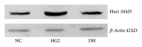 The Expression Of Notch Pathway Components After Intervention With Dapt
