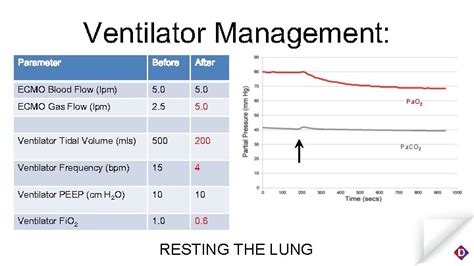 An Introduction To Vv Ecmo Andy Pybus Saint