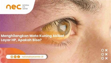 6 Fungsi Kornea Mata Dan Gangguan Kornea Mata