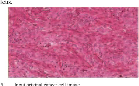 Figure 1 From Cancer Diagnosis Using Automatic Mitotic Cell Detection