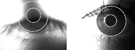 Examples Of Iris Localization Using The Proposed Technique On Some