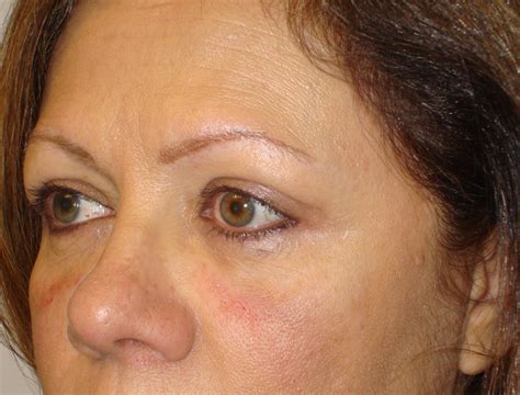 Mehryar Taban Md A Oculoplastic Surgeon Located In Beverly Hills Ca