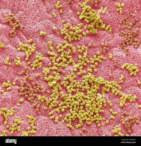 Bacteria From A Human Armpit Coloured Scanning Electron Micrograph Sem The Human Armpit
