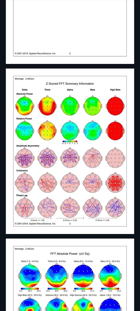 Brain Map Rneurofeedback