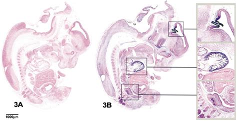 Expression Of Pstk1 Mrna In A Parasagittal Section Of An E14 Rat